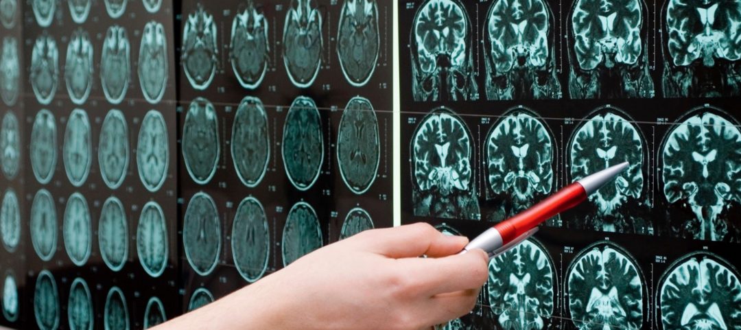 The Neuroscience of Trust: From the Brain to the Boardroom • Six Seconds